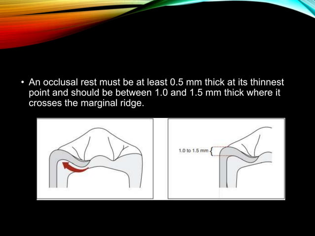 Rests and Rest Seats- prosthodontics. Autosaved pptx | PPTX