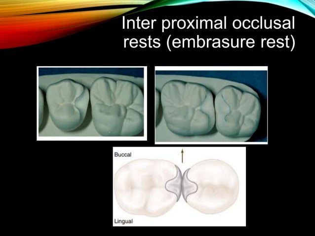 Rests and Rest Seats- prosthodontics. Autosaved pptx | PPTX