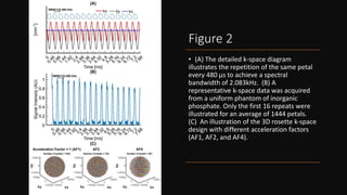 Multisite UTE 31P Rosette MRSI(PETALUTE) | PPTX