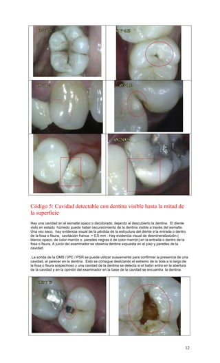 Resumen diagnostico-de-icdas | PDF