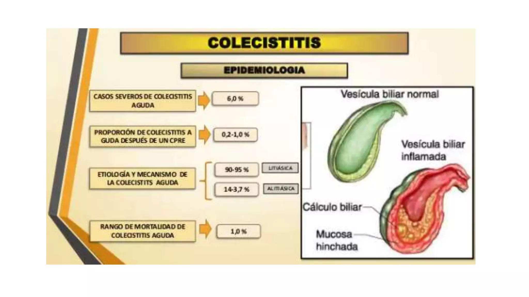 RESUMEN COLECISTITIS.pptx