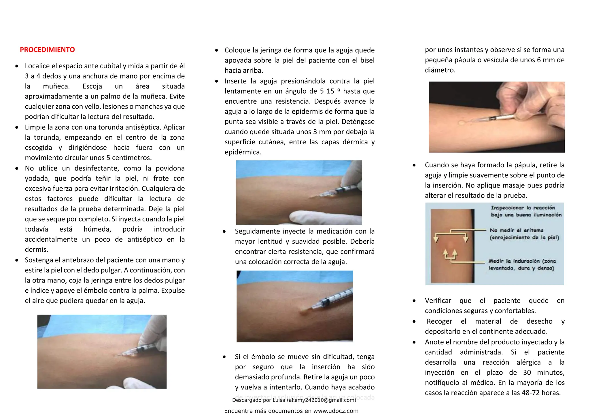 resumen via Intradermica ,zona de colocaciones,complicaciones | PDF