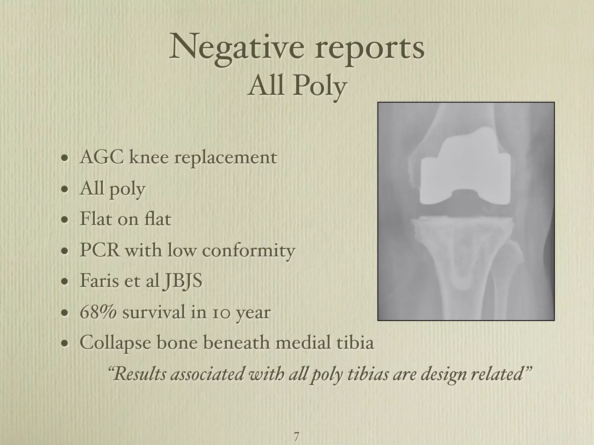 Resurrection of all poly tibia | PDF