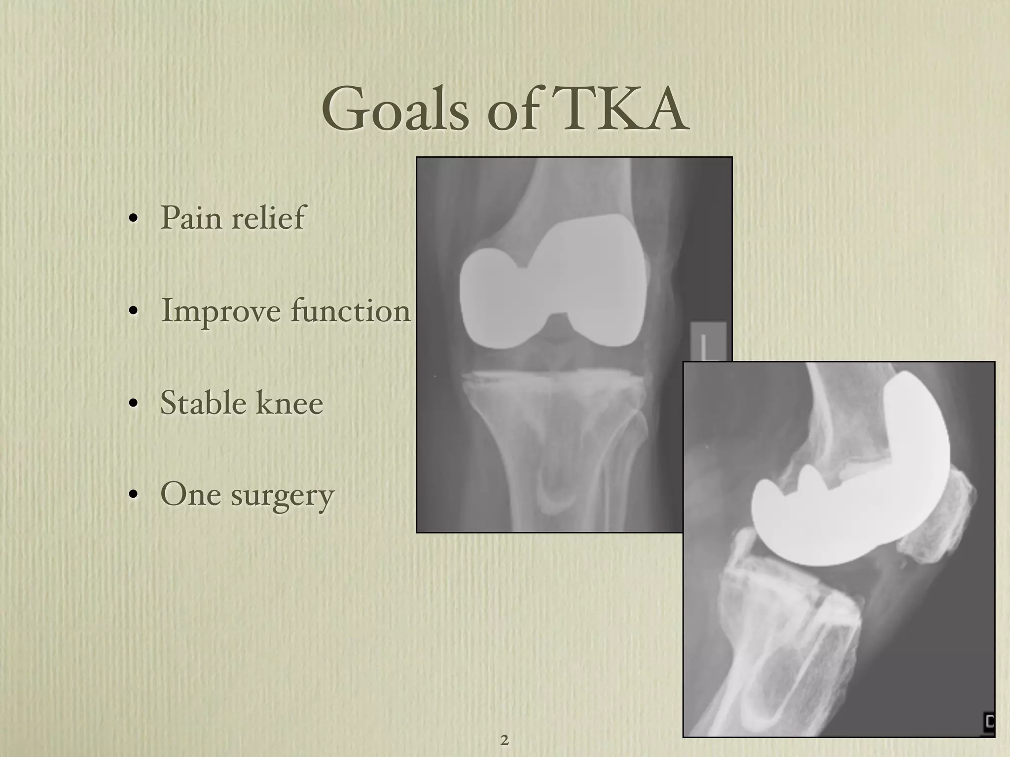 Resurrection of all poly tibia | PDF