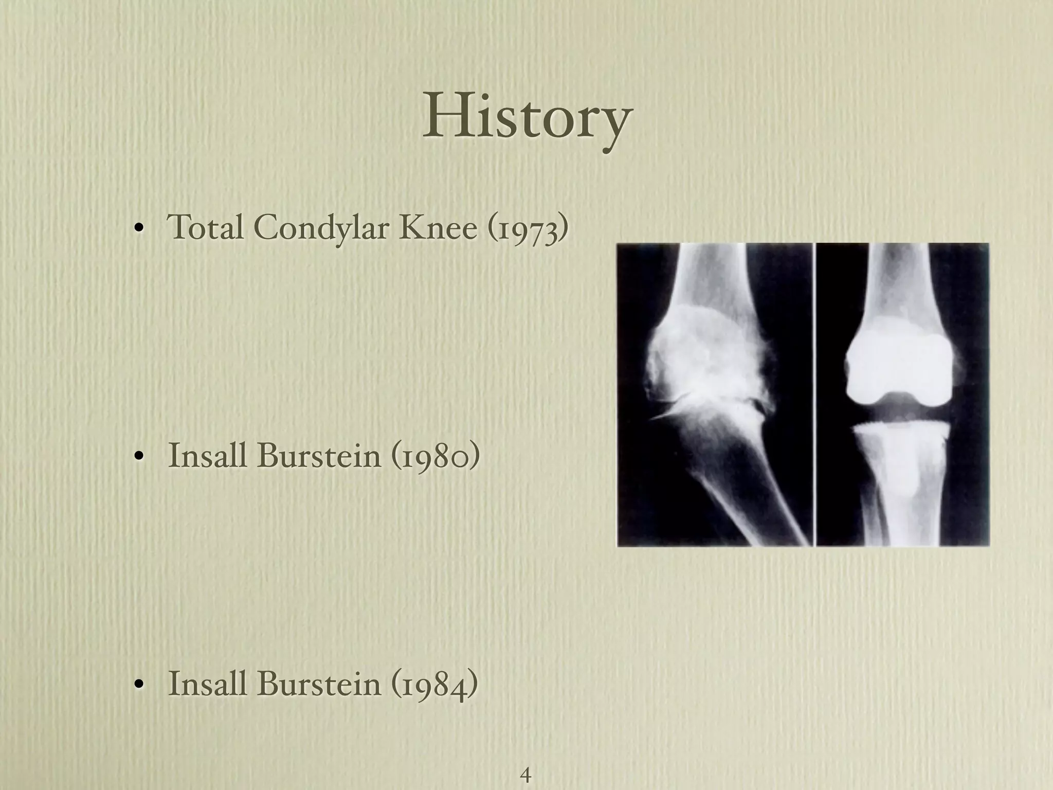 Resurrection of all poly tibia | PDF