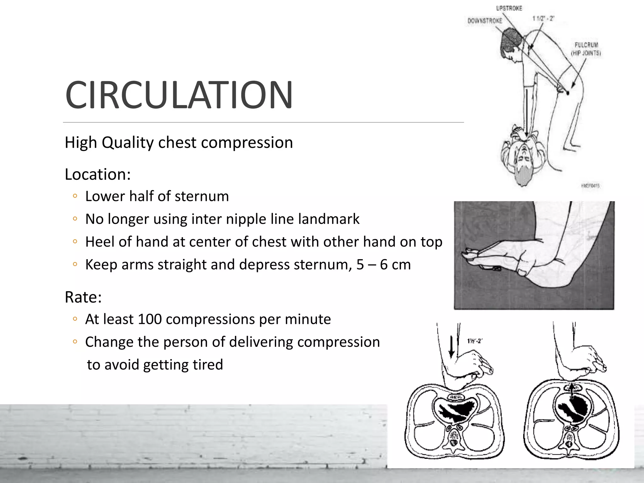 Maternal Resuscitation 2018 | PPTX