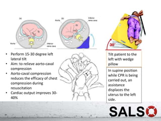 Maternal Resuscitation 2018 | PPTX