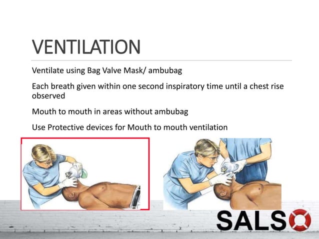 Maternal Resuscitation 2018 | PPTX | First Aid | Injuries