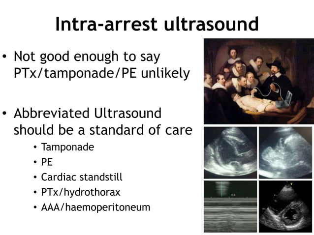 Resuscitation, ALS/APLS/ATLS are just the beginning.... | PPT