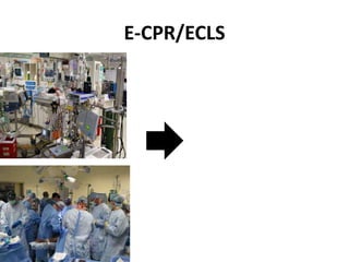 Resuscitation, ALS/APLS/ATLS are just the beginning.... | PPT