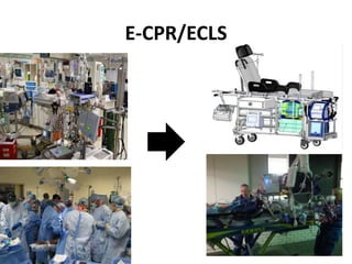 Resuscitation, ALS/APLS/ATLS are just the beginning.... | PPT