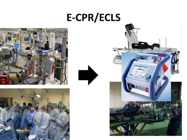 Resuscitation, ALS/APLS/ATLS are just the beginning.... | PPT