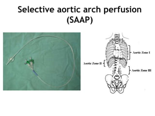 Resuscitation, ALS/APLS/ATLS are just the beginning.... | PPT