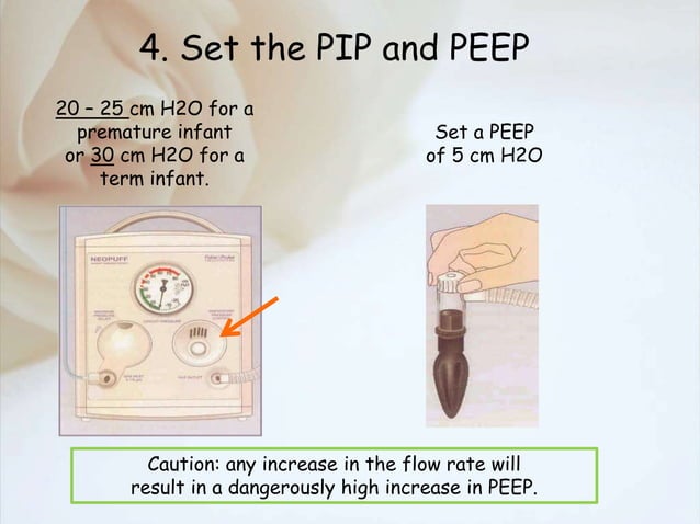 Different breathing techniques for resuscitation for neonates | PPT
