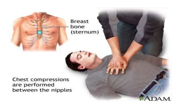 (Resuscitation in ICU) lecture of resuscitation.pptx