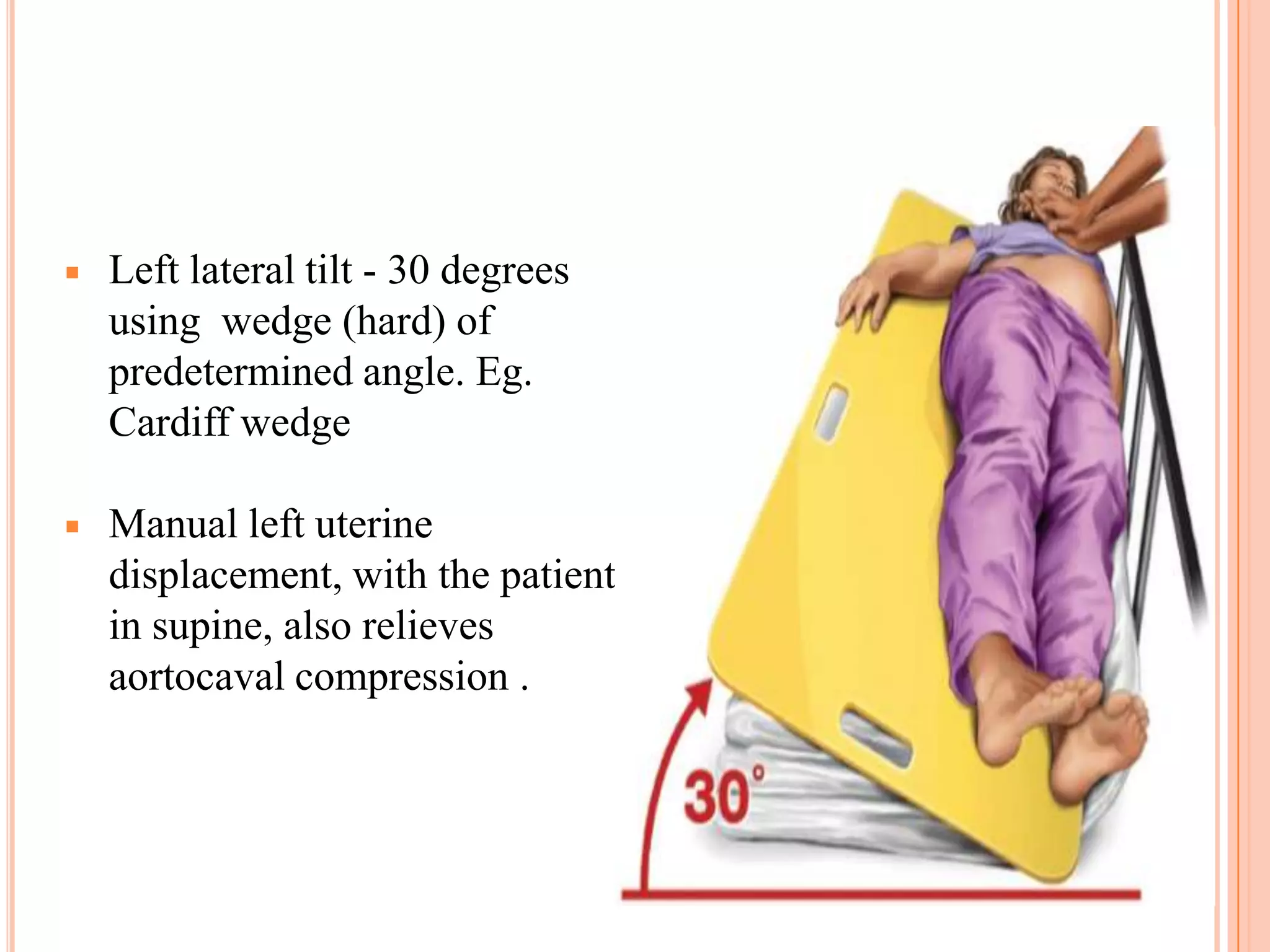 Resuscitation in pregnancy dr.krushna patel | PPTX