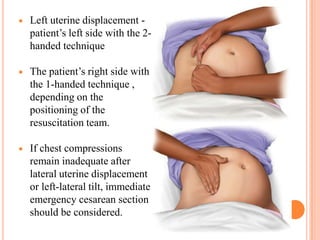 Resuscitation in pregnancy dr.krushna patel | PPTX