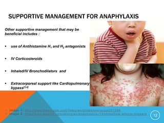 Resuscitation techniques in anaphylaxis | PPTX