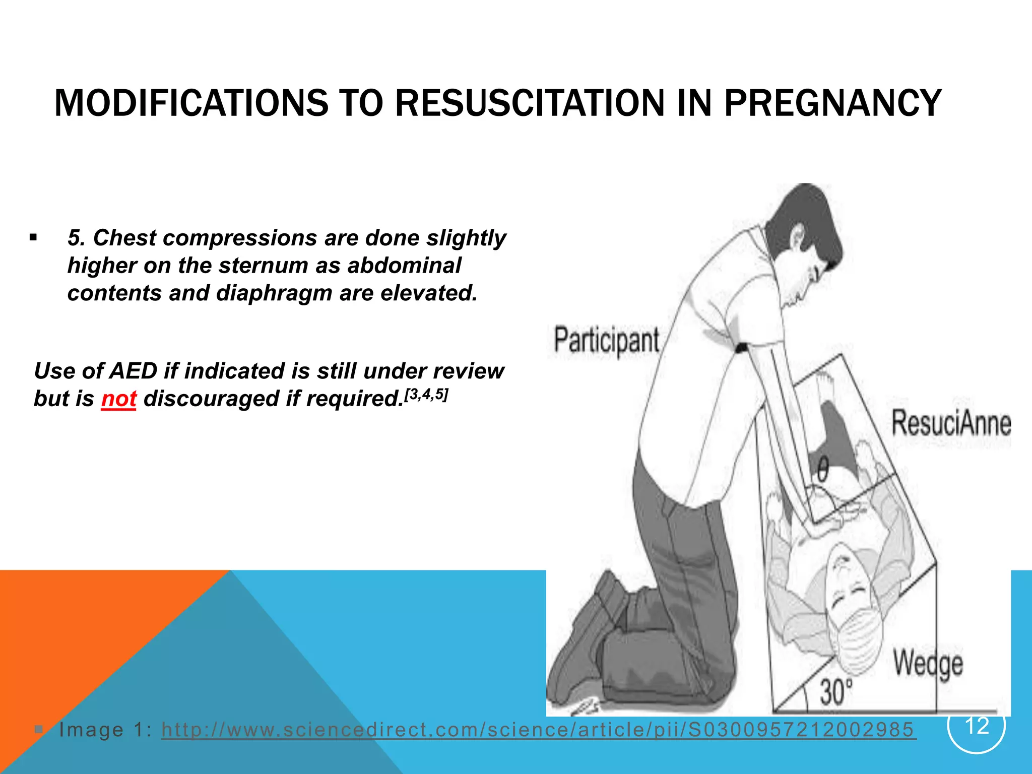Resuscitation techniques in pregnancy | PPTX