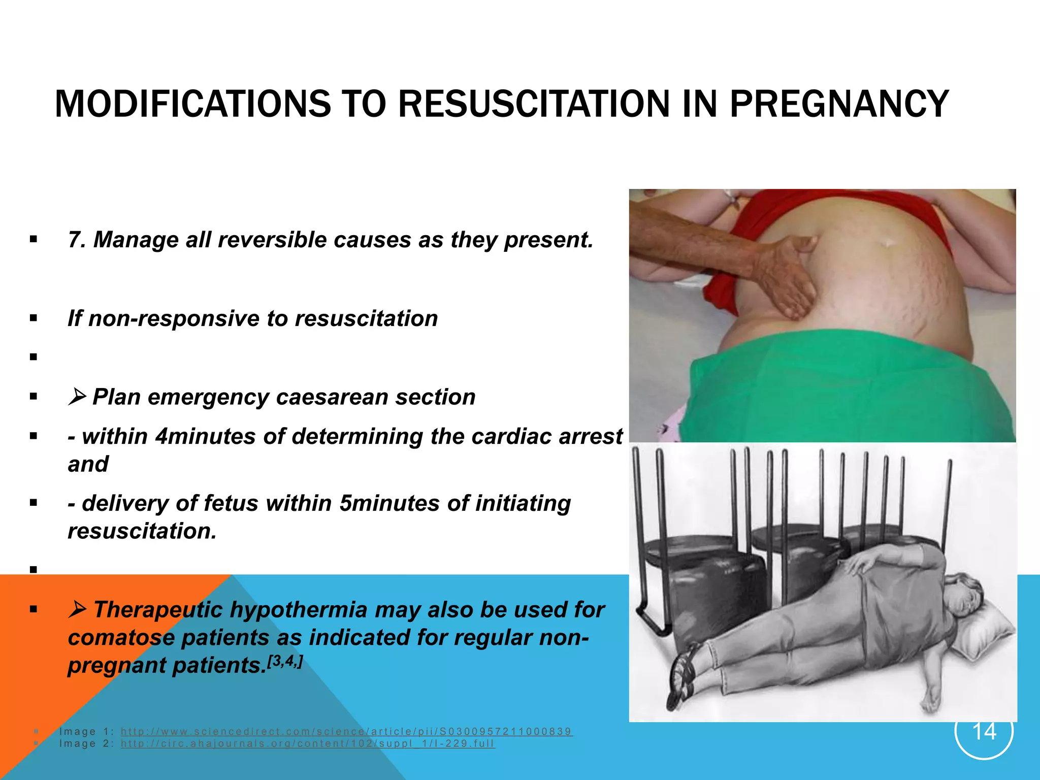 Resuscitation techniques in pregnancy | PPTX