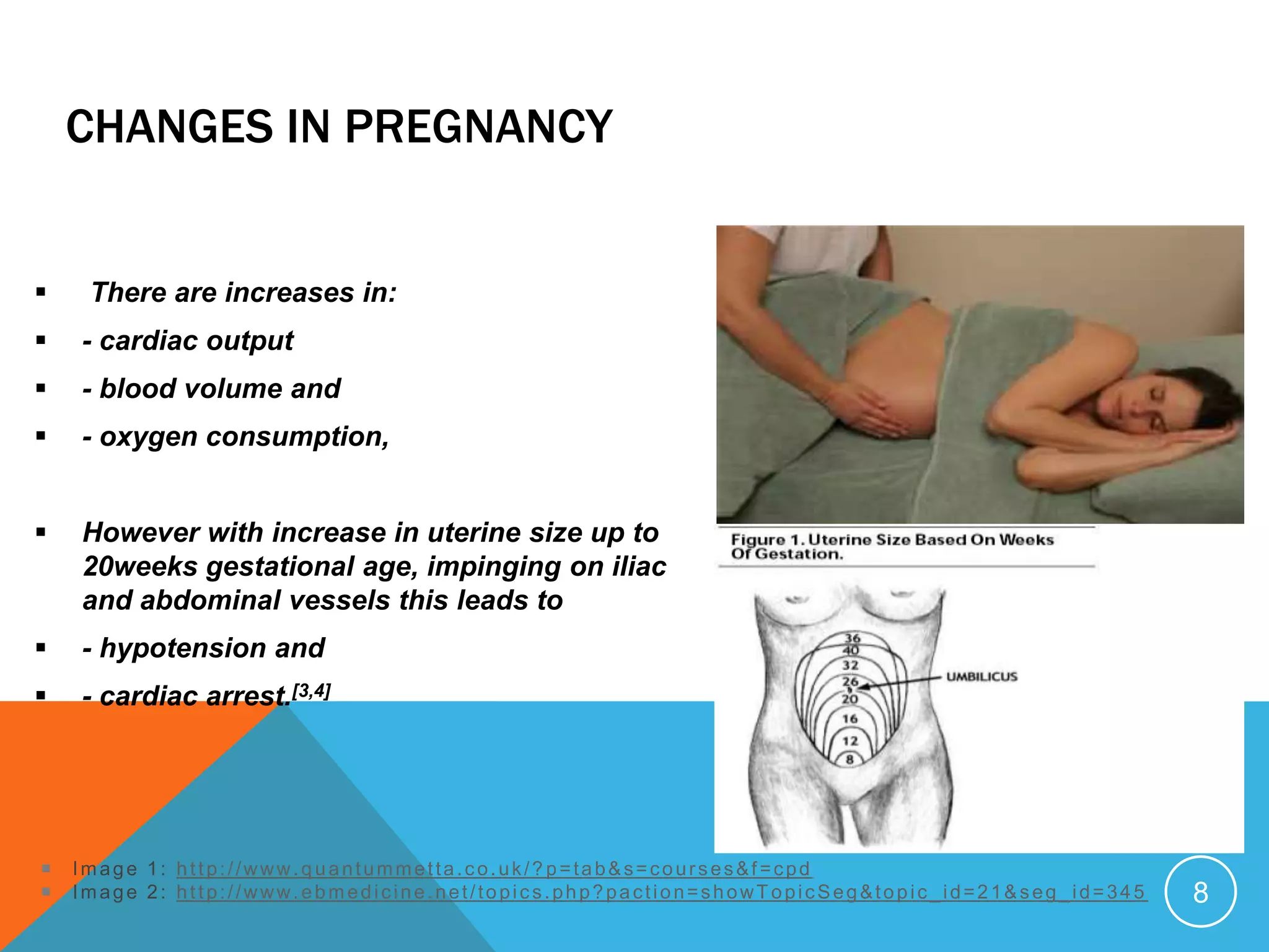 Resuscitation techniques in pregnancy | PPTX