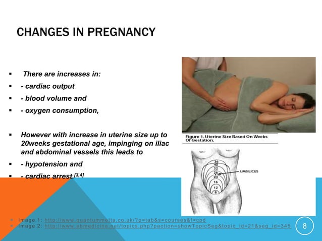 Resuscitation techniques in pregnancy | PPTX