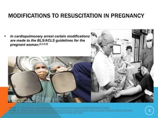 Resuscitation techniques in pregnancy | PPTX