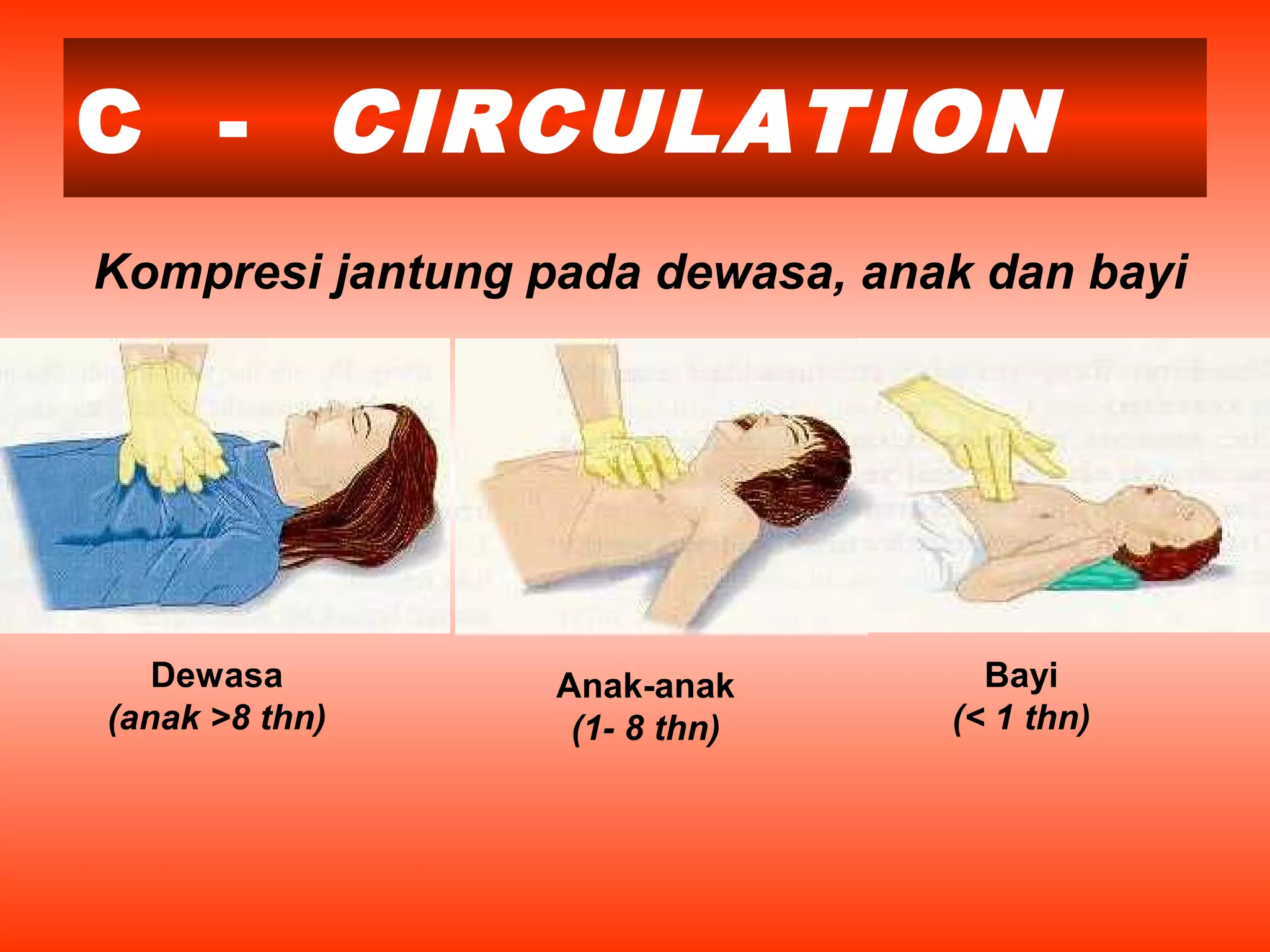 Prosedur Resusitasi jantung-paru | PPT