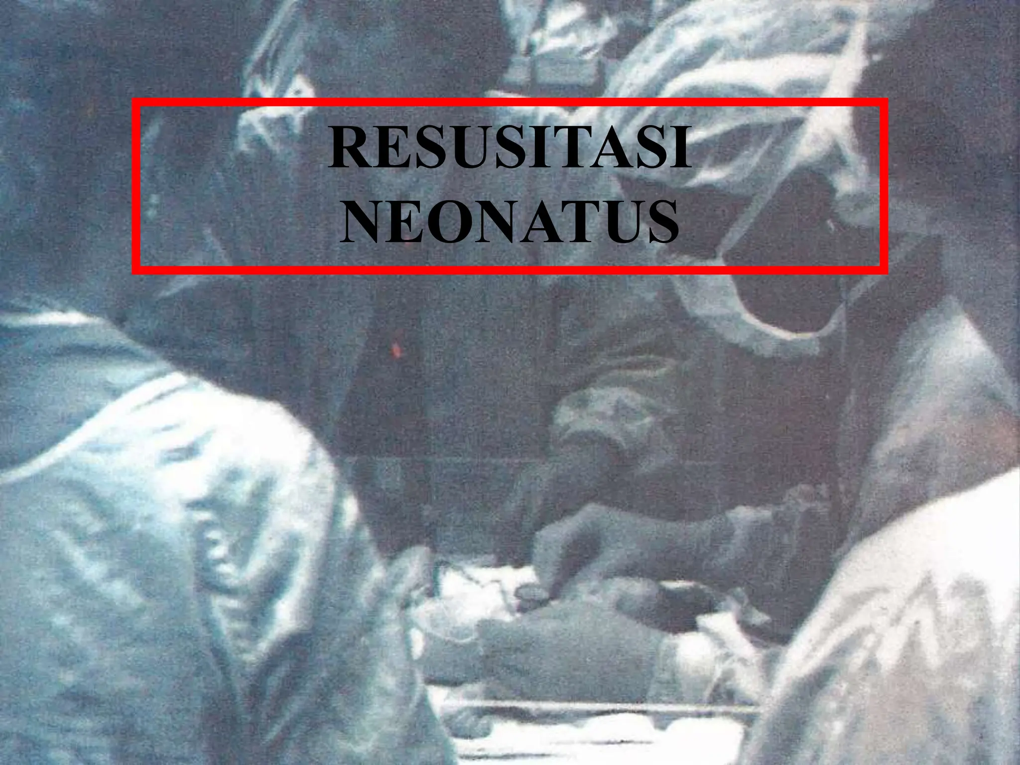 resusitasi-neonatusppt.ppt