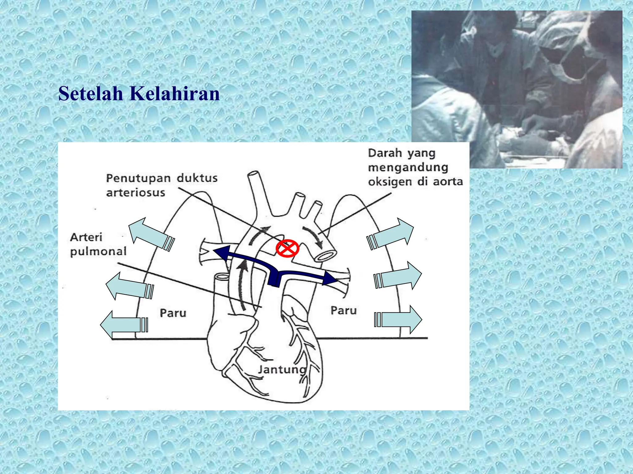 resusitasi-neonatusppt.ppt