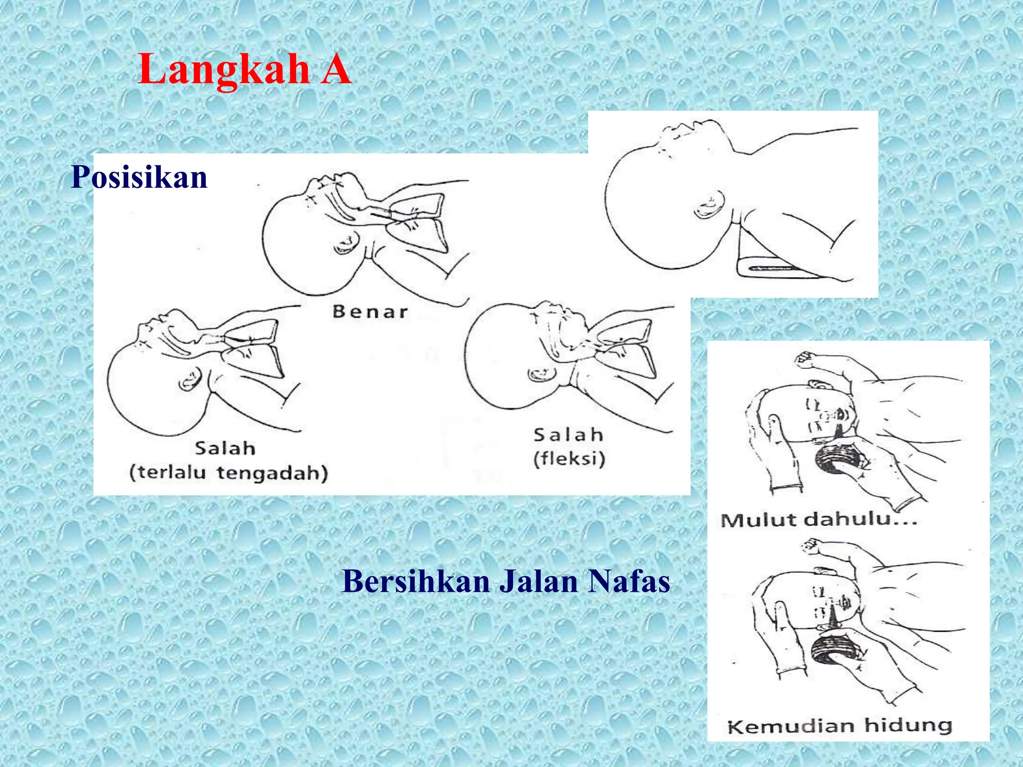 resusitasi-neonatusppt.ppt