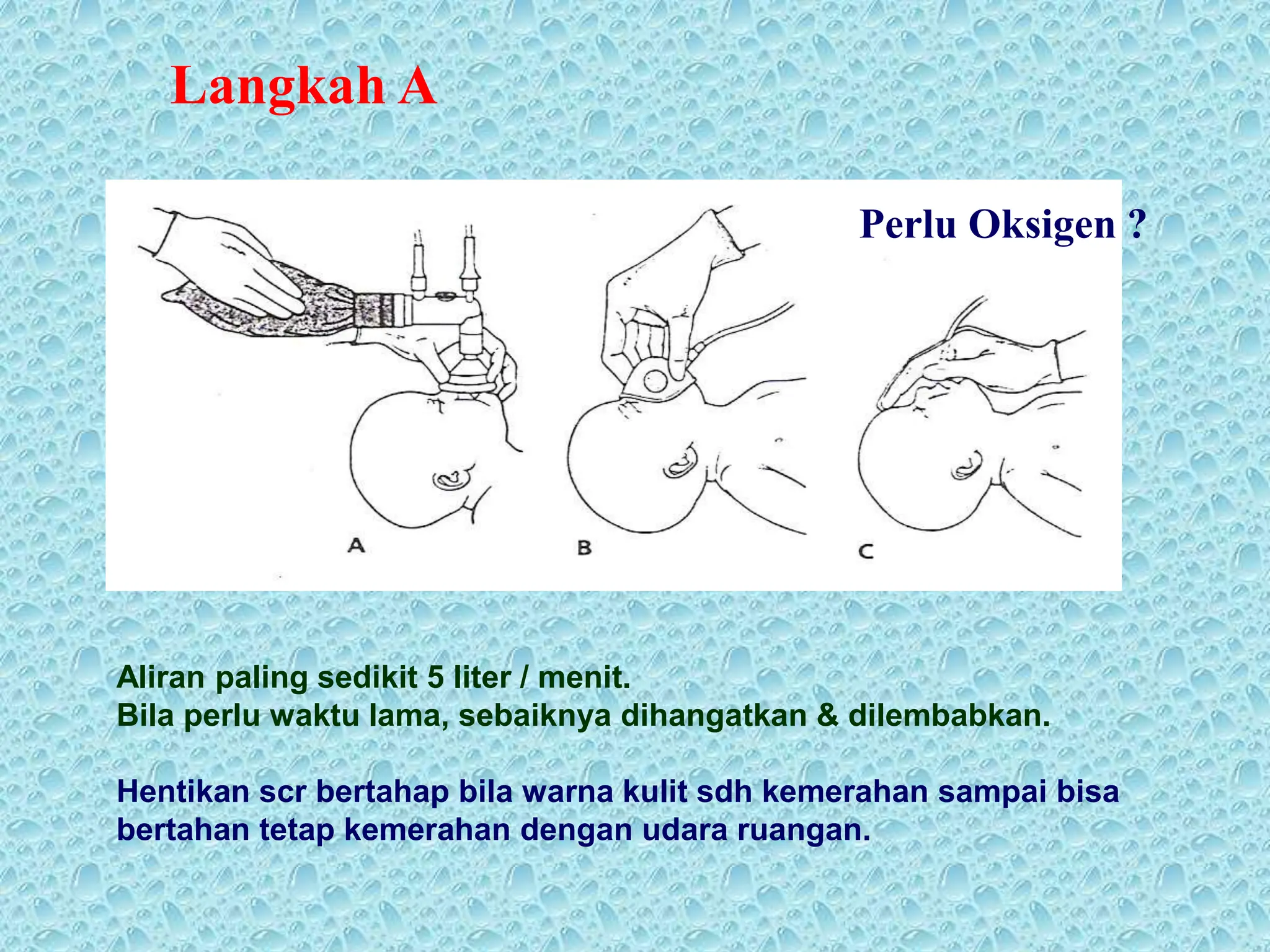 resusitasi-neonatusppt.ppt