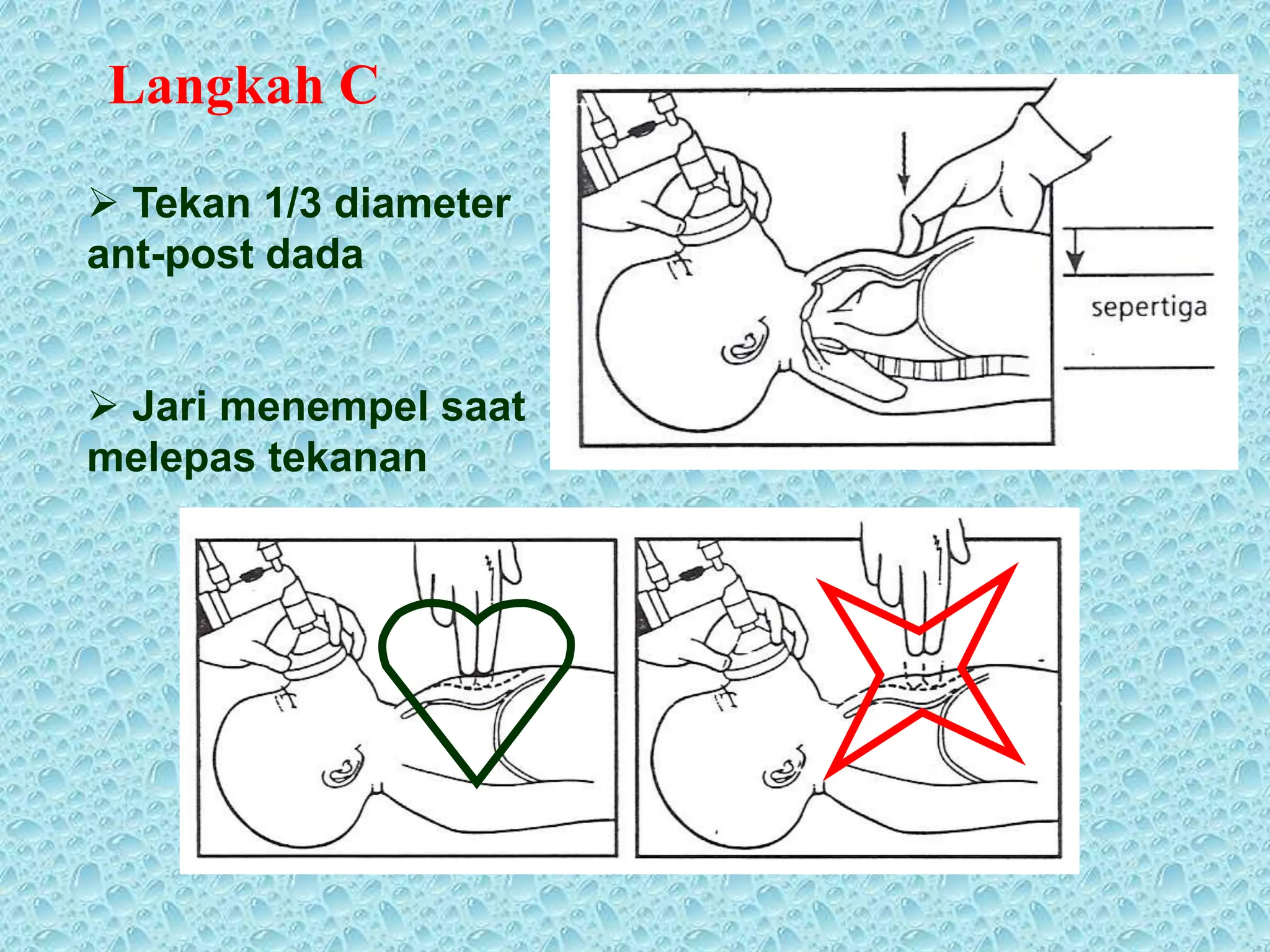 resusitasi-neonatusppt.ppt