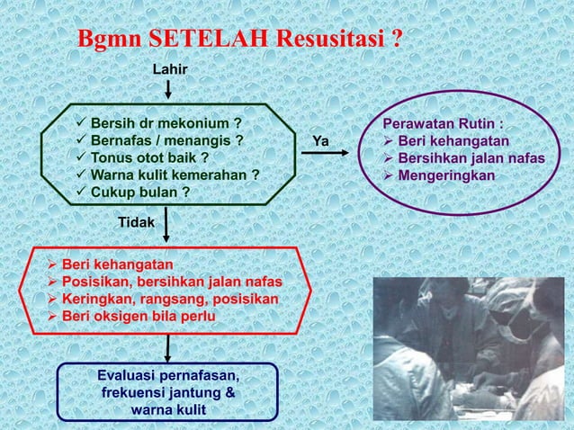 resusitasi-neonatusppt.ppt