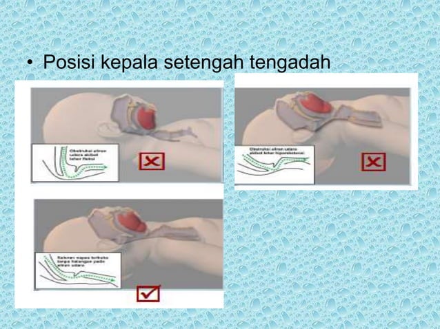 resusitasi-neonatusppt.ppt
