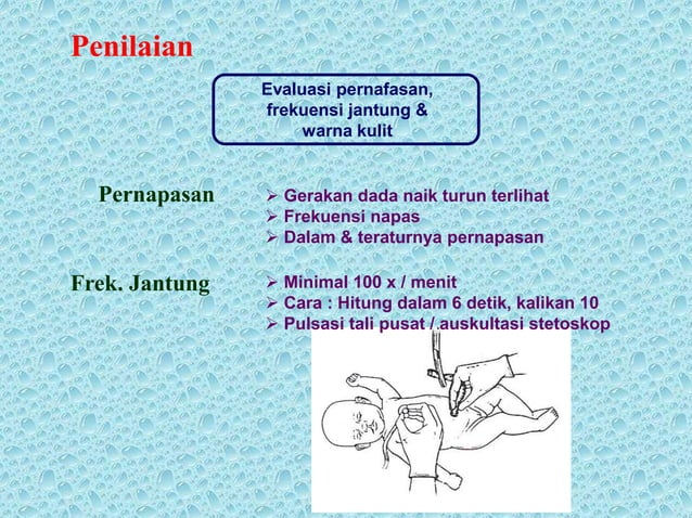 resusitasi-neonatusppt.ppt