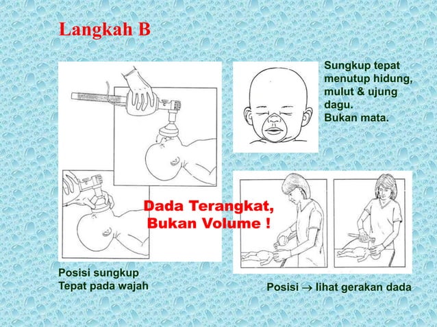 resusitasi-neonatusppt.ppt