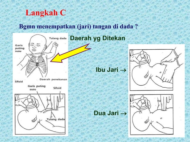 resusitasi-neonatusppt.ppt