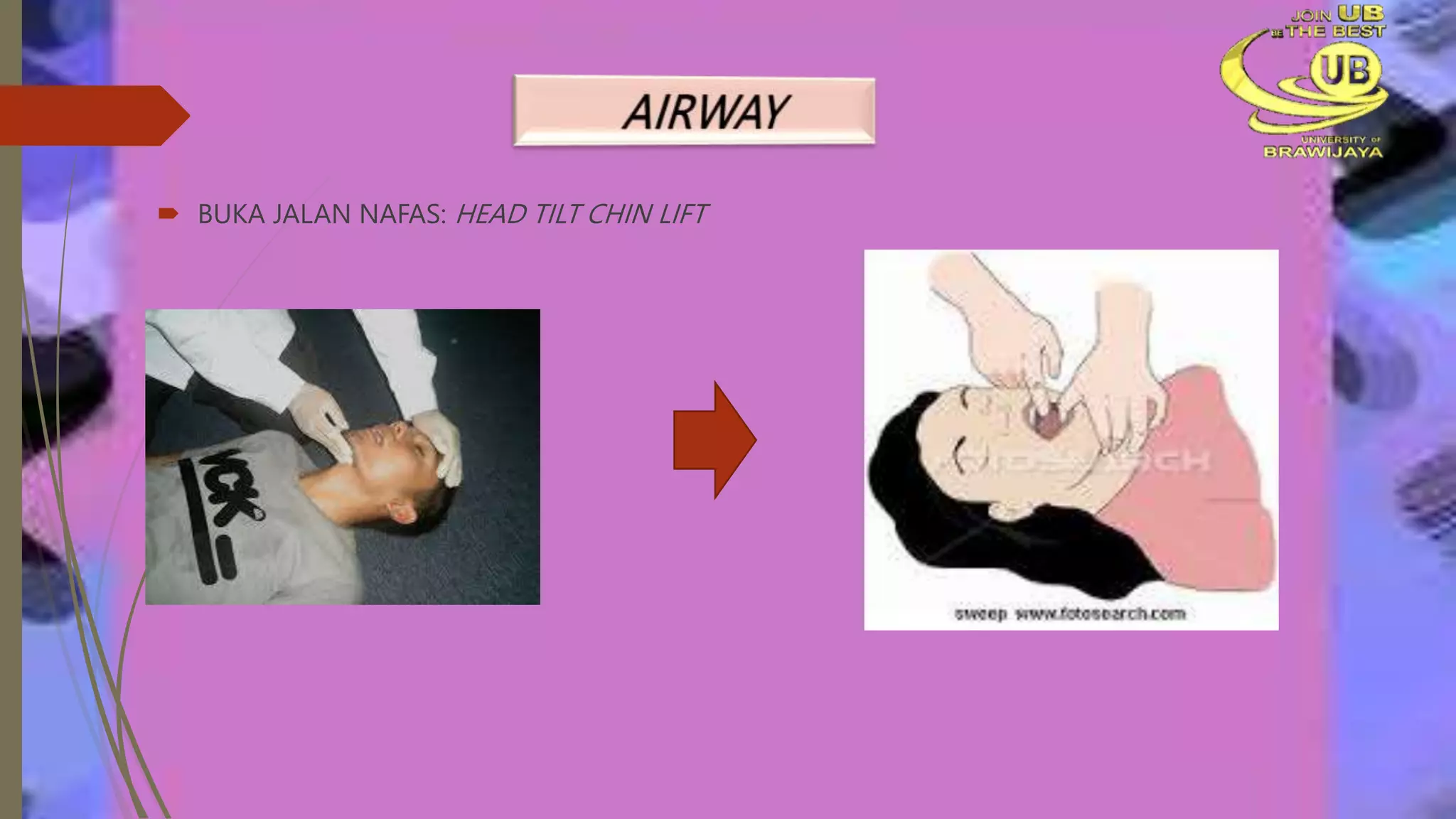 Resusitasi jantung.ppt