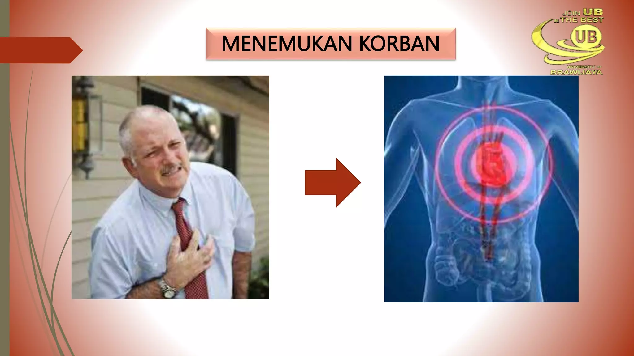 Resusitasi jantung.ppt