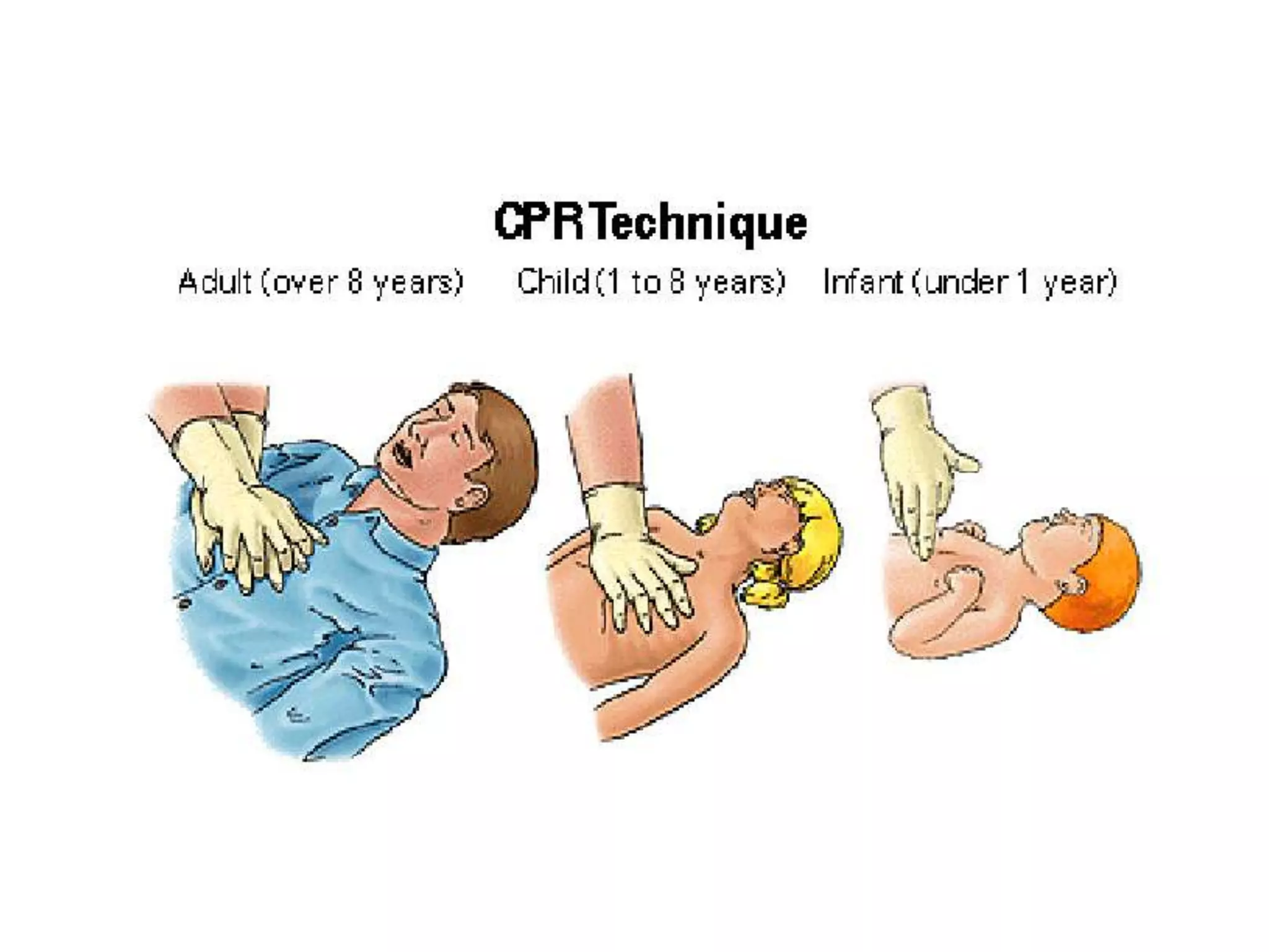 Resusitasi jantung paru | PPTX