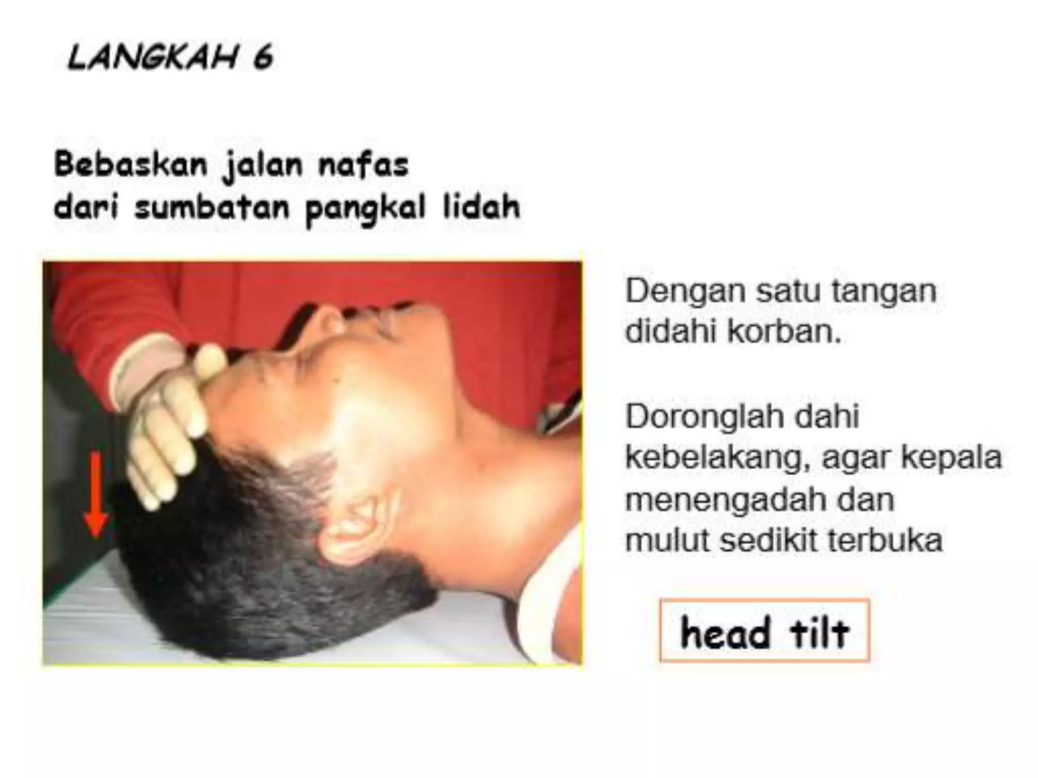 Resusitasi jantung paru otak | PPTX