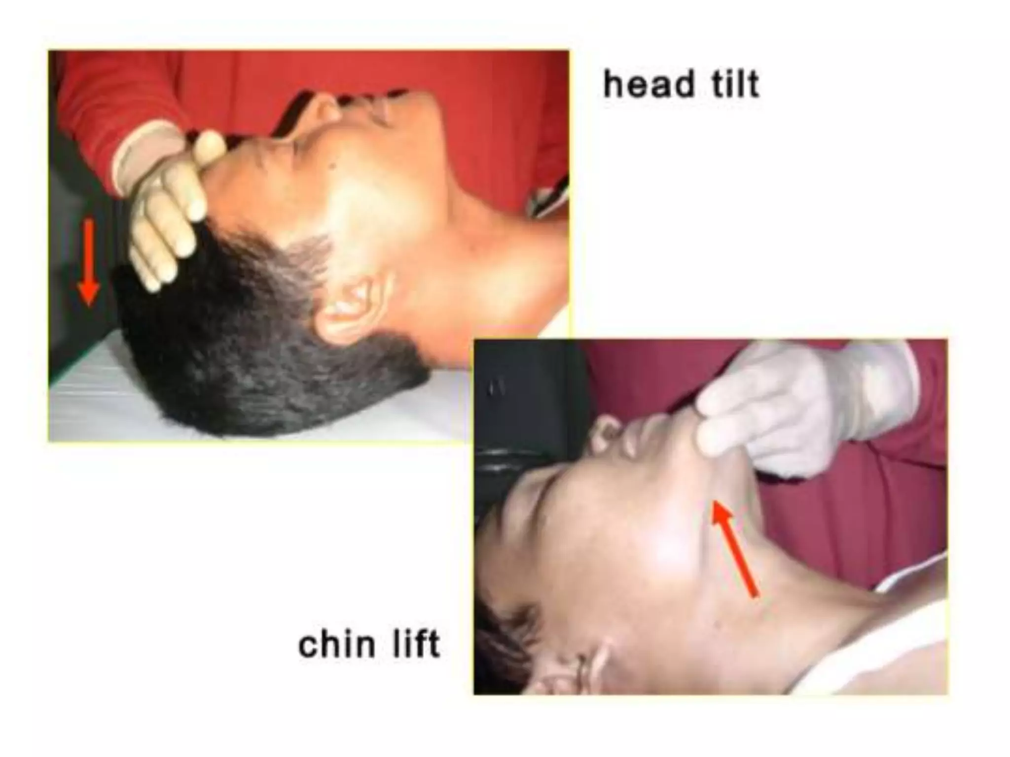 Resusitasi jantung paru otak | PPTX