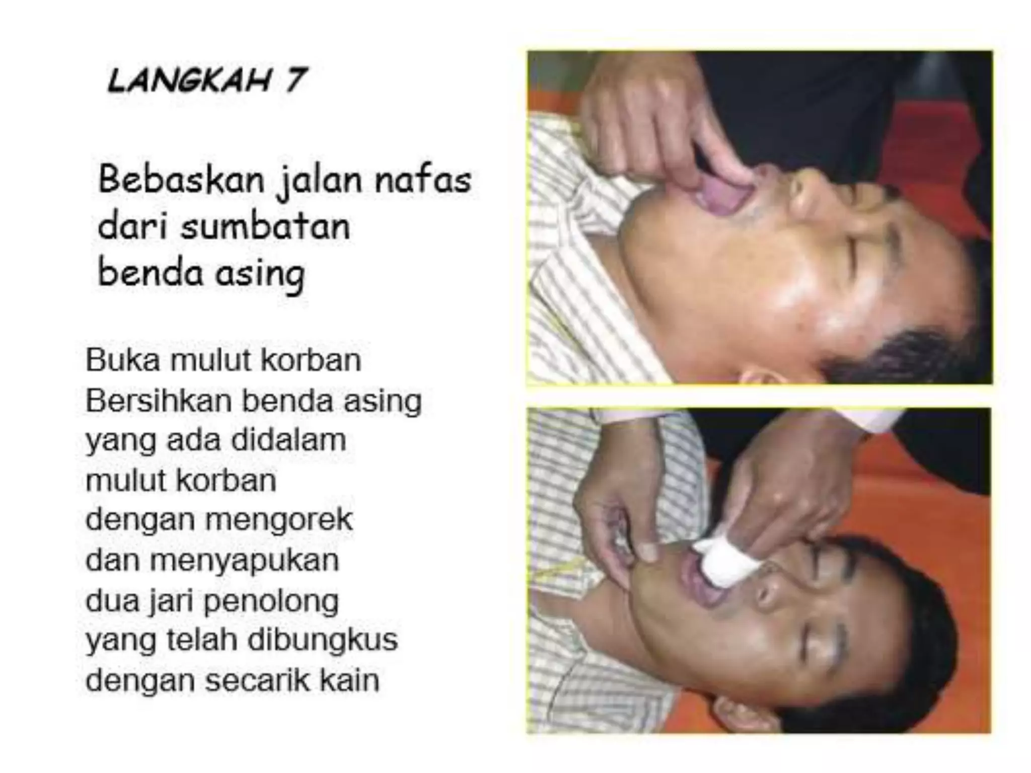 Resusitasi jantung paru otak | PPTX