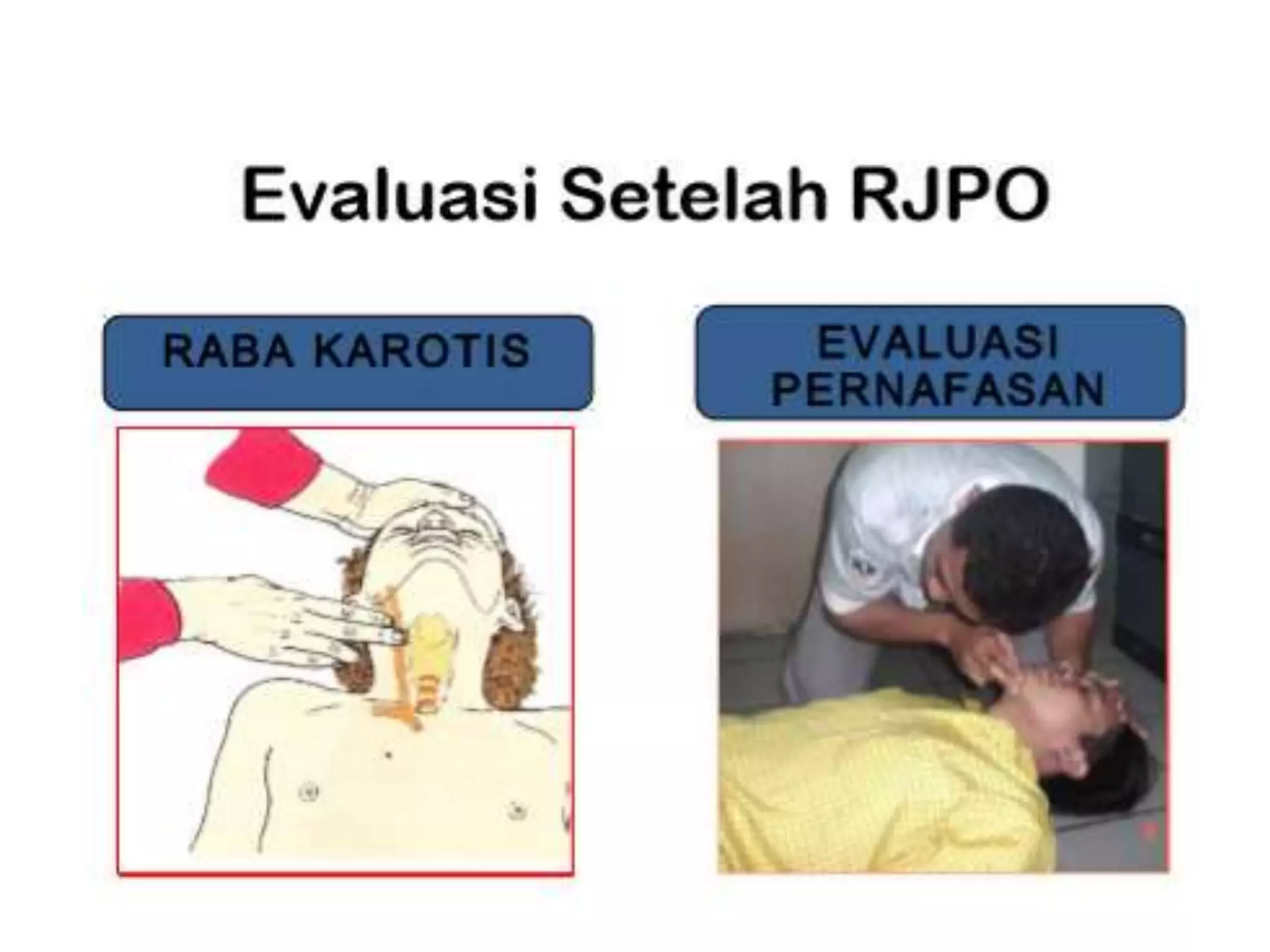 Resusitasi jantung paru otak | PPTX