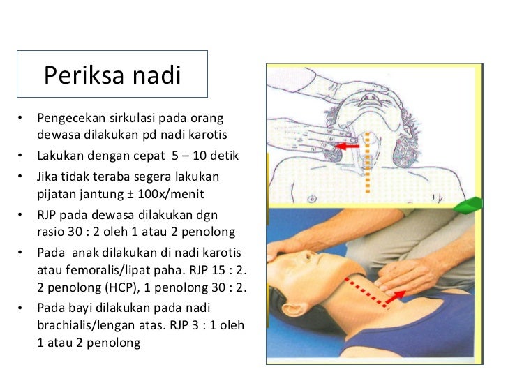 Resusitasi jantung paru pada dewasa dan anak