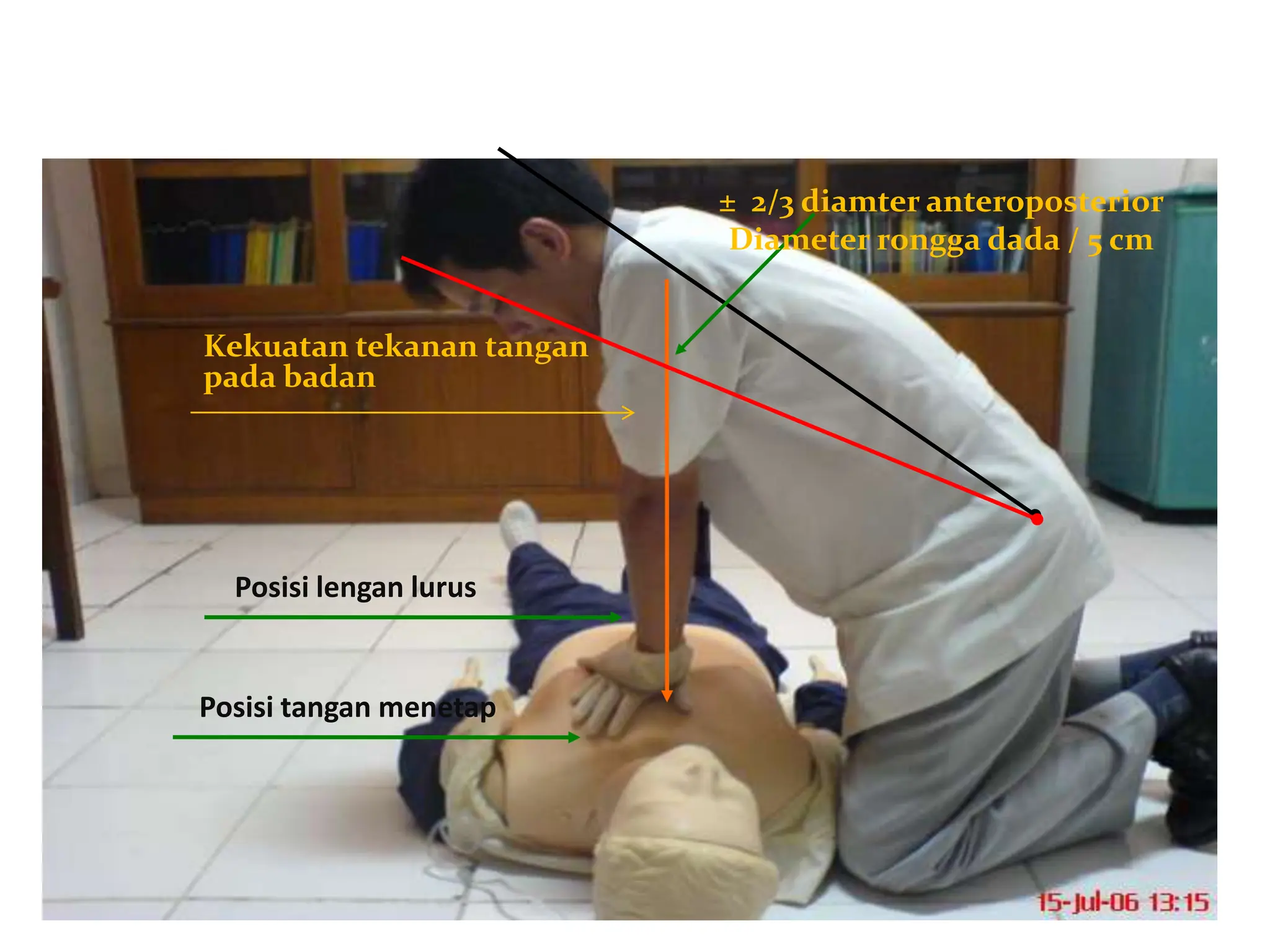 Resusitasi Jantung Paru Pada Dewasa dan Anak.pptx