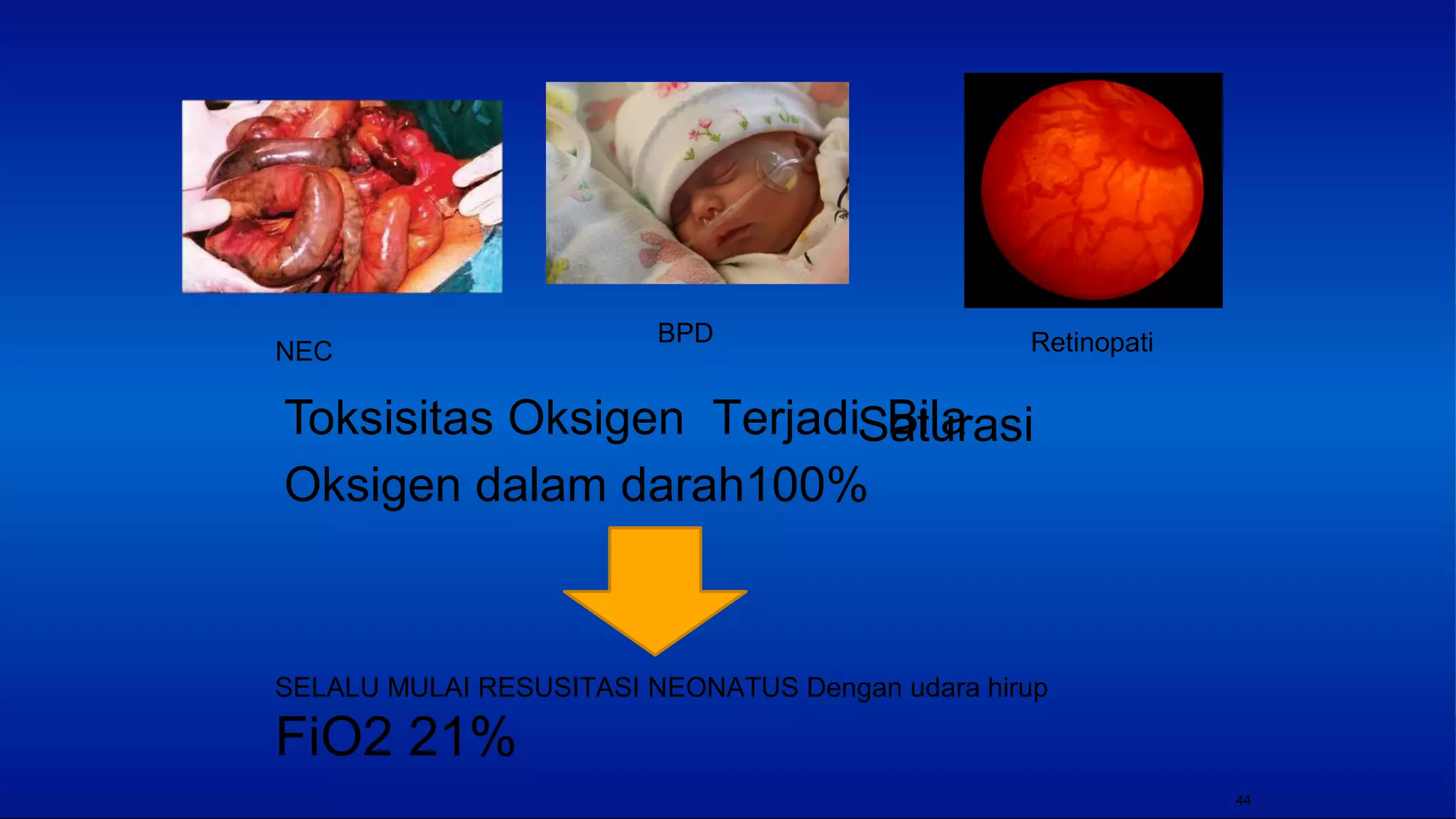 Resusitasi Neonatus.pdf