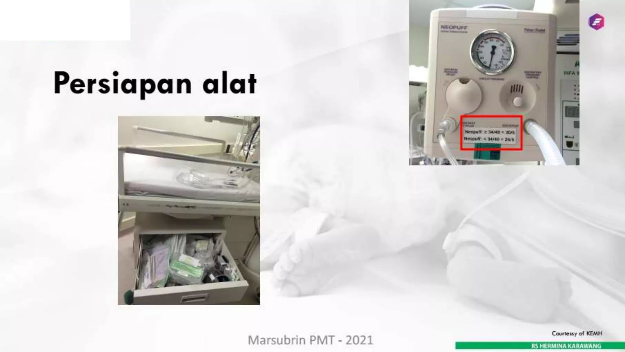 RESUSITASI NEONATUS Ibnu Arda'im- Orientasi dr. Chrisna, Sp.A.pptx | Free download