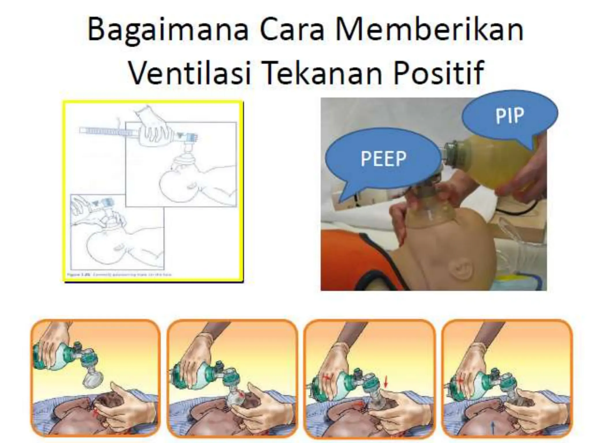 power point RESUSITASI NEONATUS / bayi baru lahir | PPTX